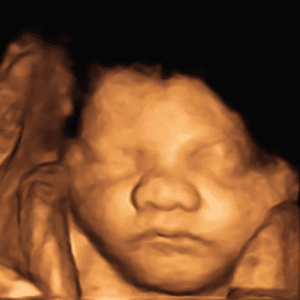 Ultrasounds - Transparent Medical Imaging