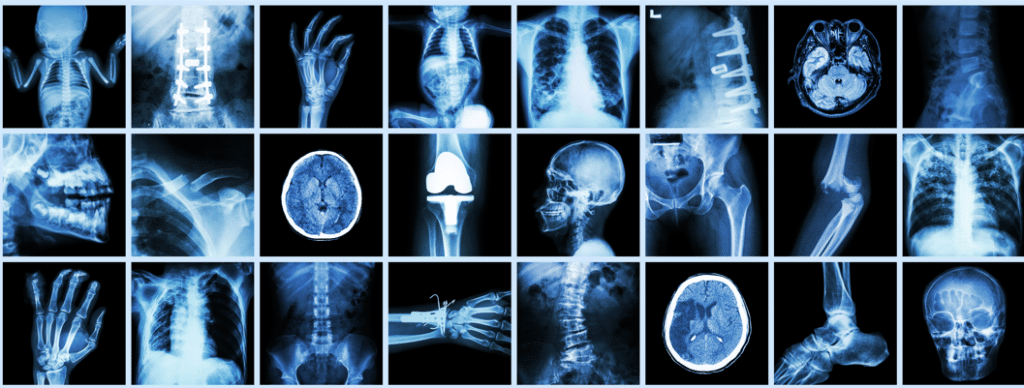 X-Rays - Transparent Medical Imaging